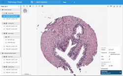 Proscia and Huron Digital Pathology Partner to Provide Seamlessly Integrated Digital Pathology ...